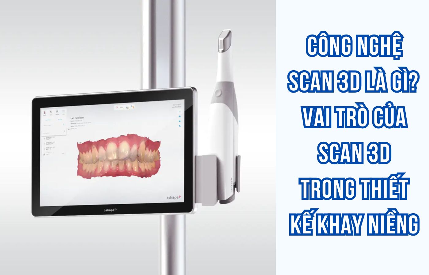 Công nghệ scan 3D là gì? Vai trò của scan 3D trong thiết kế khay niềng ...